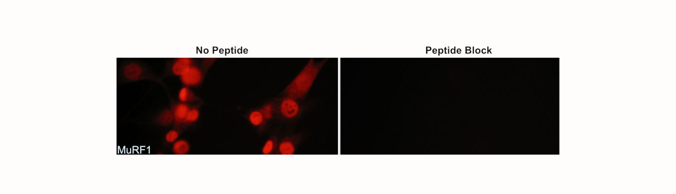 Atrogin-1 and MuRF1: Markers of skeletal muscle atrophy | PhosphoSolutions
