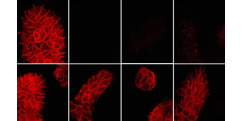 Antibody Kits from PhosphoSolutions | Antibodies Inc.