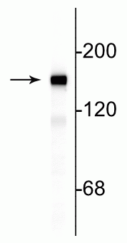 Anti-Neurofilament NF-M Antibody | 1455-NFM
