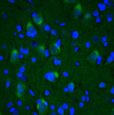Anti-LRRK2/Dardarin, C-Terminus Recombinant Chicken Chimeric mAb | 78-253