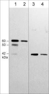 Anti-Sphingosine Kinase 1 (C-terminal region) | SM5401