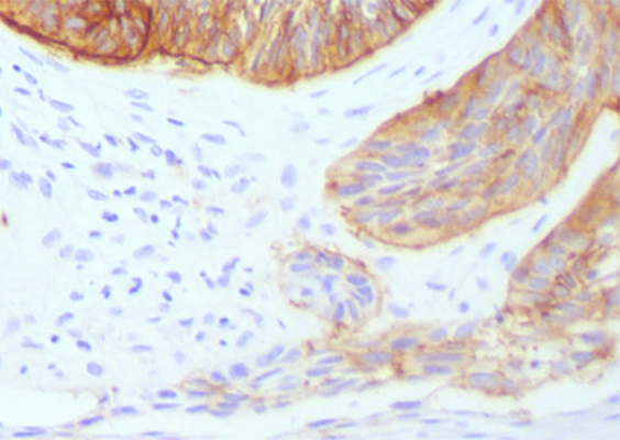 Fast Red Super ™ | AR-8211-01