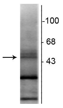 Anti-Retinoic Acid Receptor, ß-Isotype Antibody | 1340-RXRB