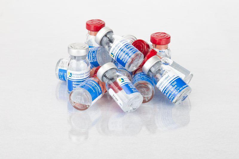 ANA Speckled Positive Control Diagnostic Kit | 15-131