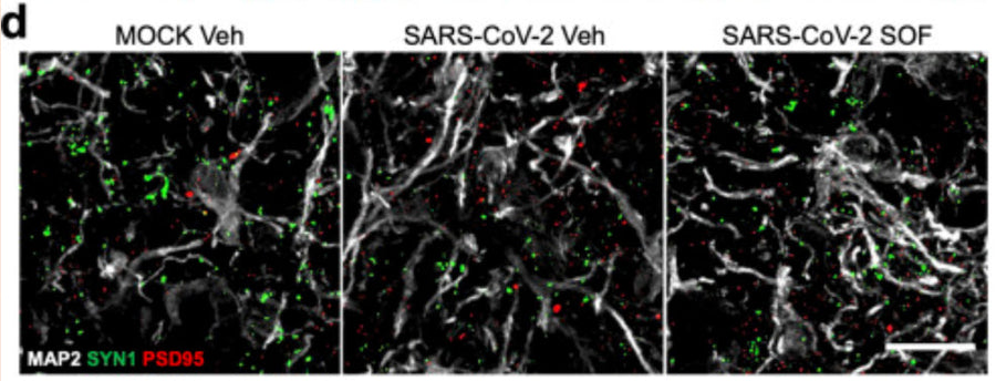 Anti-PSD-95 Antibody (K28/43) | 75-028 Anti-PSD-95 Antibody (K28/43) | 75-028